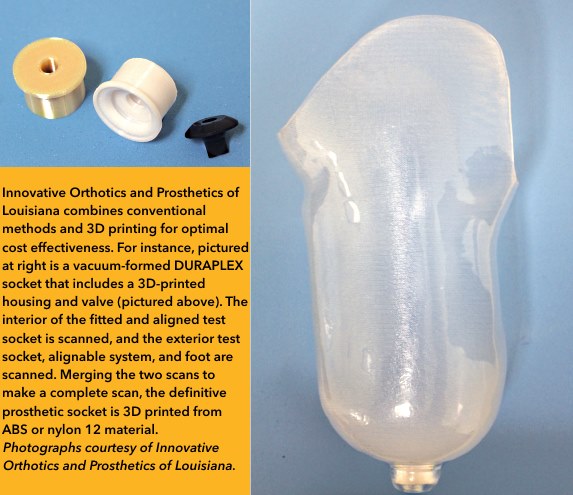 3D Printing Gains Momentum in Clinical O&P - The O&P EDGE Magazine