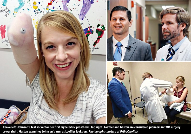 Tiffany Johnson: TMR Was the Right Choice After Shark Attack - The O&P ...