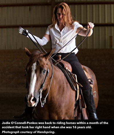 Jodie O’Connell-Ponkos: Prosthesis Helps Equestrian Do What She Loves ...