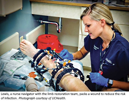 UCHealth’s Limb Restoration Program: Returning Patients to Their ...