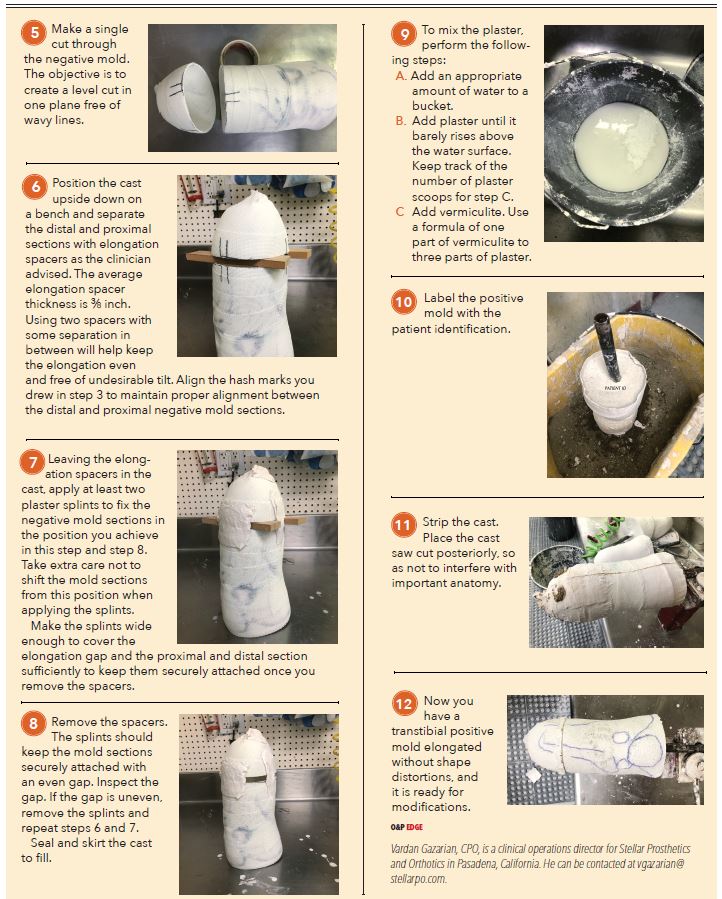 Filling a Transtibial Elongated Positive Plaster Mold - The O&P EDGE ...