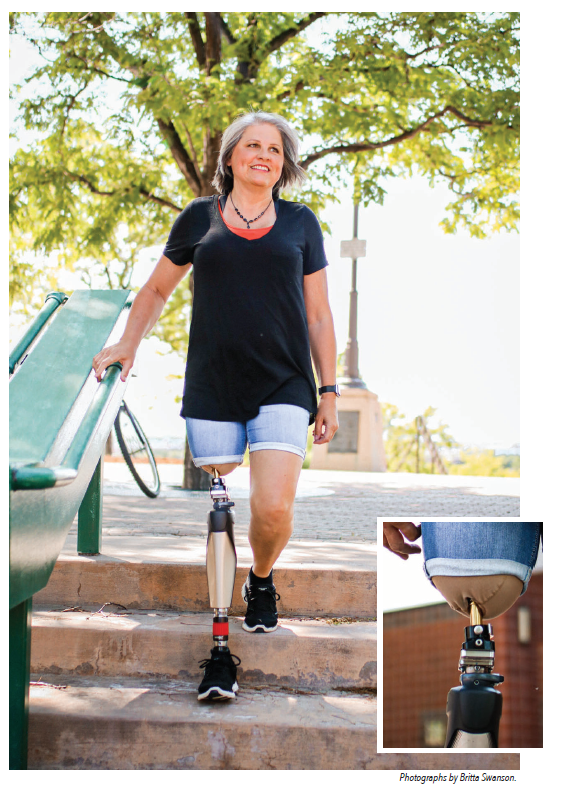 Two Approaches to Osseointegration Surgery - The O&P EDGE Magazine