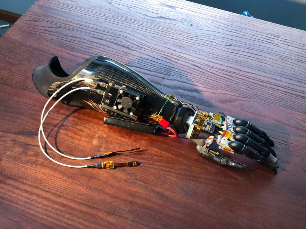 AI Gives More Accurate, Less Invasive Prosthetic Control - The O&P EDGE ...