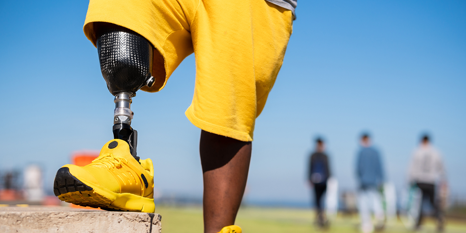 Current Technology Available for Prosthetic Alignment - The O&P EDGE ...