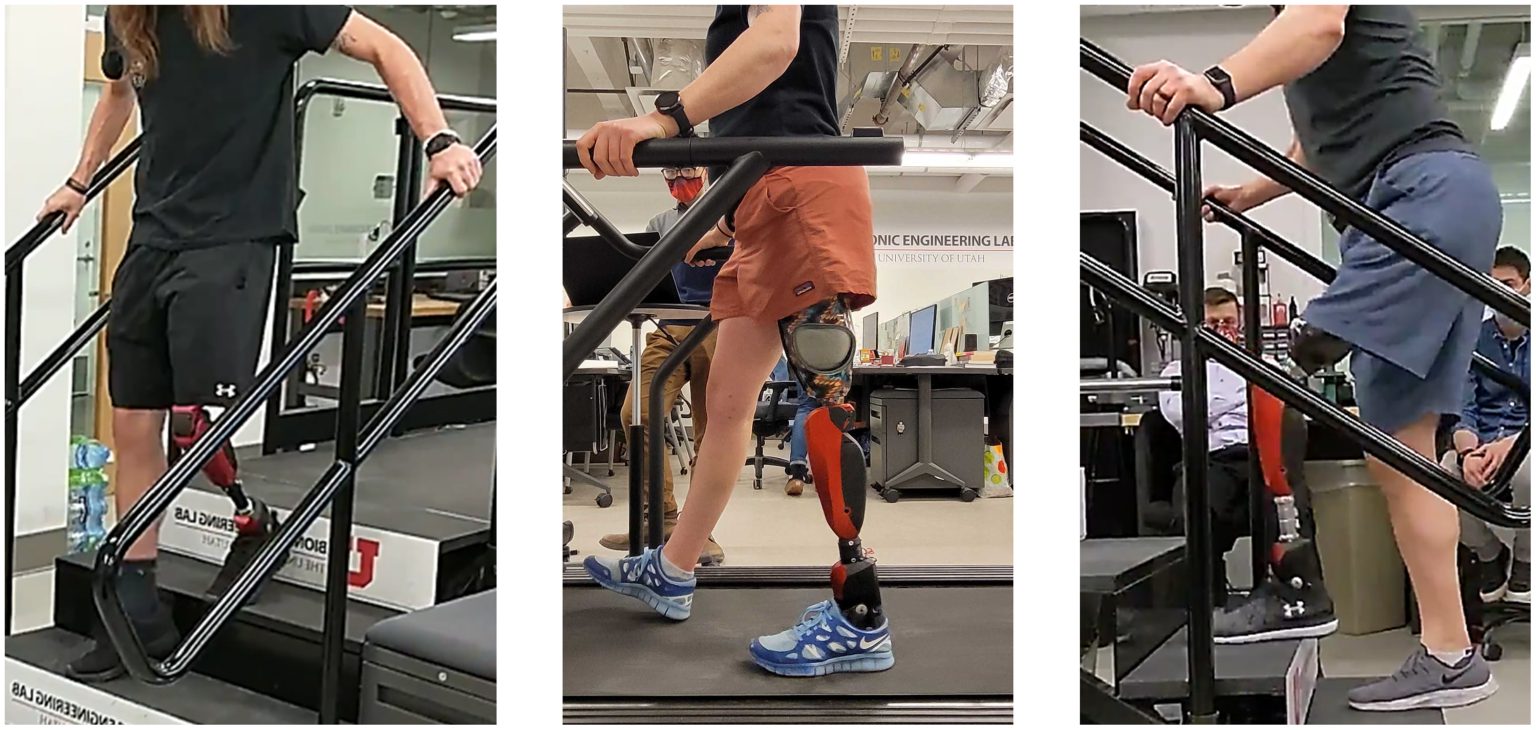 Prosthesis Replicates Natural Leg Biomechanics - The O&P EDGE Magazine