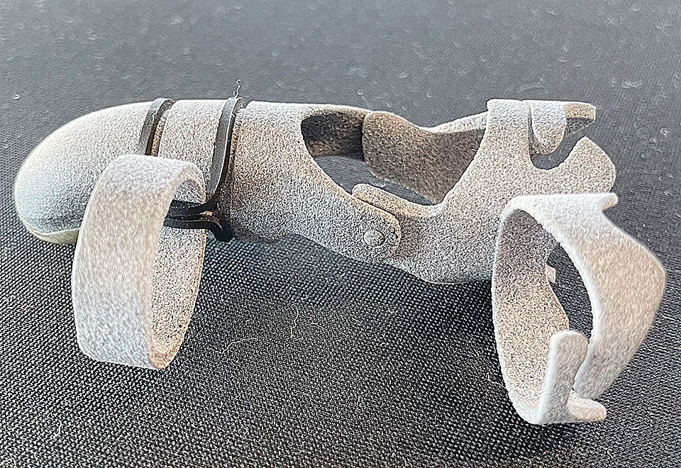 Grant Awarded to Provide Finger Prosthesis - The O&P EDGE Magazine