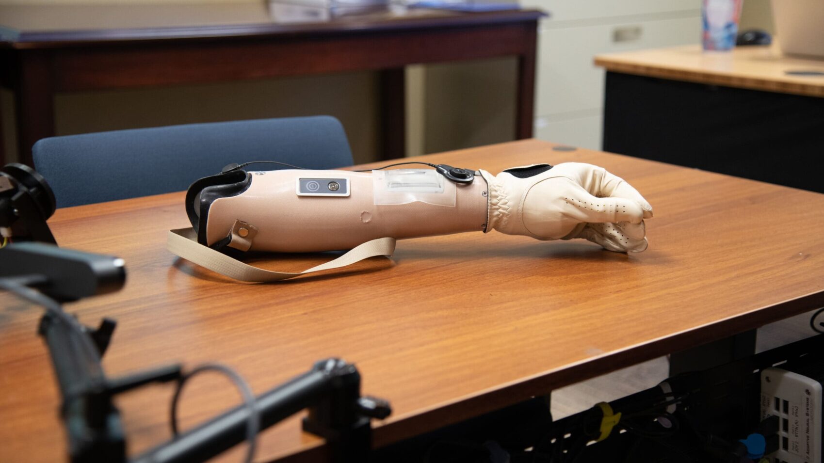 O&P Company Joins Medical Team Restoring Prosthetic Sense of Touch ...