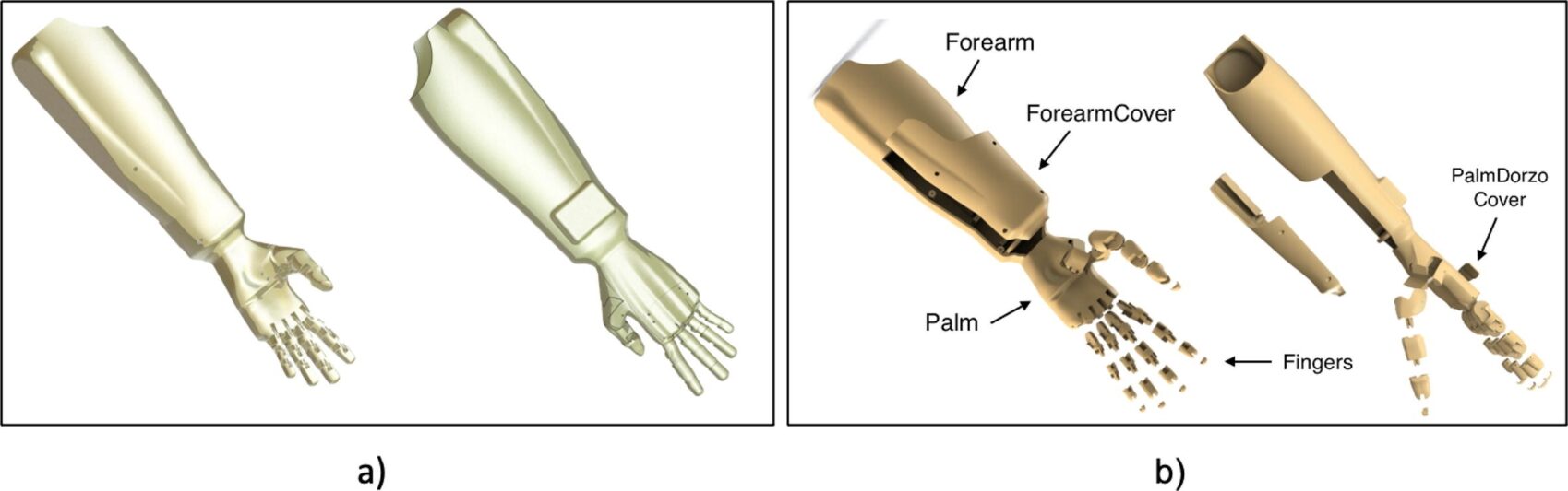 EEG Versus EMG Prosthesis Control Yields Affordable Device - The O&P EDGE Magazine
