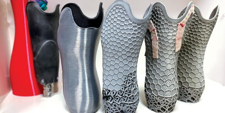 Defining “Definitive”: 3D-printed Lower-limb Sockets Meet the Challenge ...