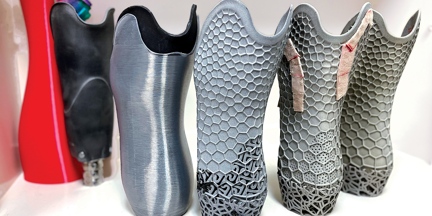 Defining “Definitive”: 3D-printed Lower-limb Sockets Meet the Challenge ...