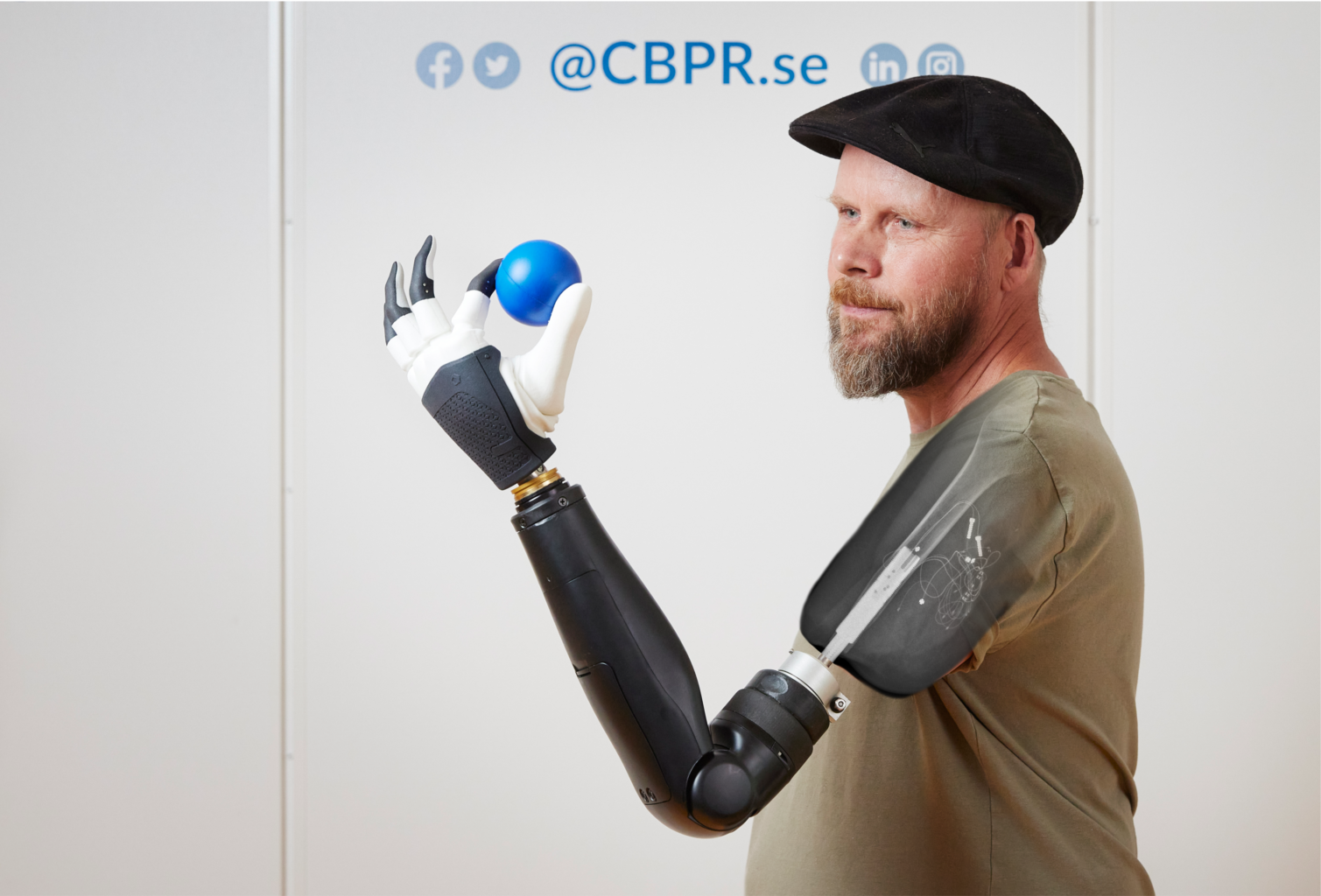 Innovation Enables Unprecedented Control of Prosthetic Hand - The O&P ...