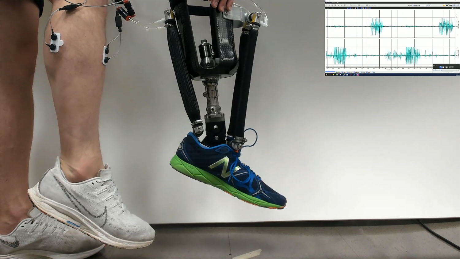 Robotic Prosthetic Ankles Improve Movement, Stability - The O&P EDGE ...