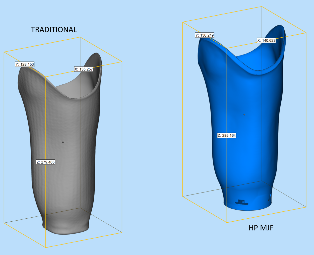 Comparing 3D-Printed Versus Carbon Fiber Prosthetic Sockets - The O&P ...