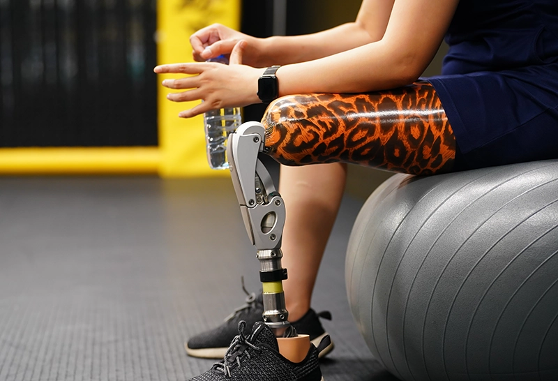 Prosthesis Sophistication Affects Mobility, Satisfaction Differently by ...