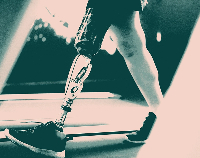 Gait Symmetry and Lower-limb Dominance - The O&P EDGE Magazine